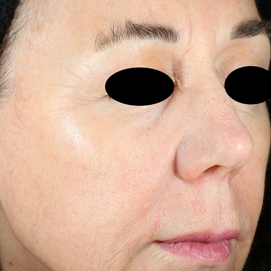 Welcome To Aesthetic Laser Care Safe Comfortable Reliable Process Welcome To Aesthetic Laser Care Safe Comfortable Reliable Process